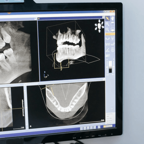 The Importance of Dental X-Rays (Radiographs): Why They Matter for Your ...